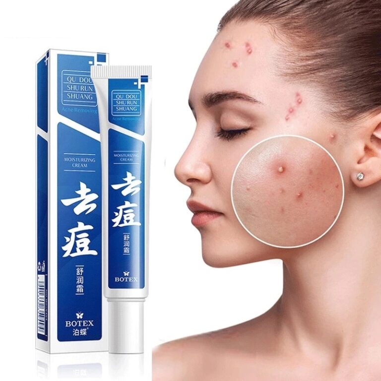Effective Acne Removal Cream Acne Treatment Anti-acne Repair Fade Acne ...